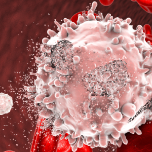 First-in-Human Study of Revumenib Shows ‘Promising’ Activity in Acute ...